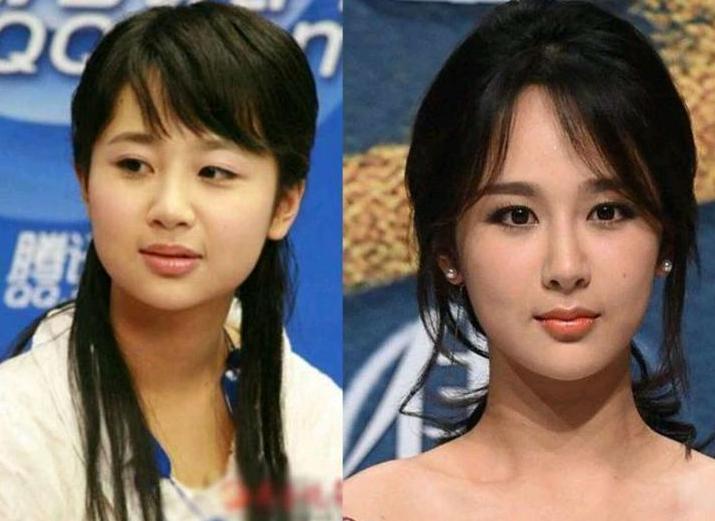 The cheeks are sunken, the nose is transparent, and the traces of ...