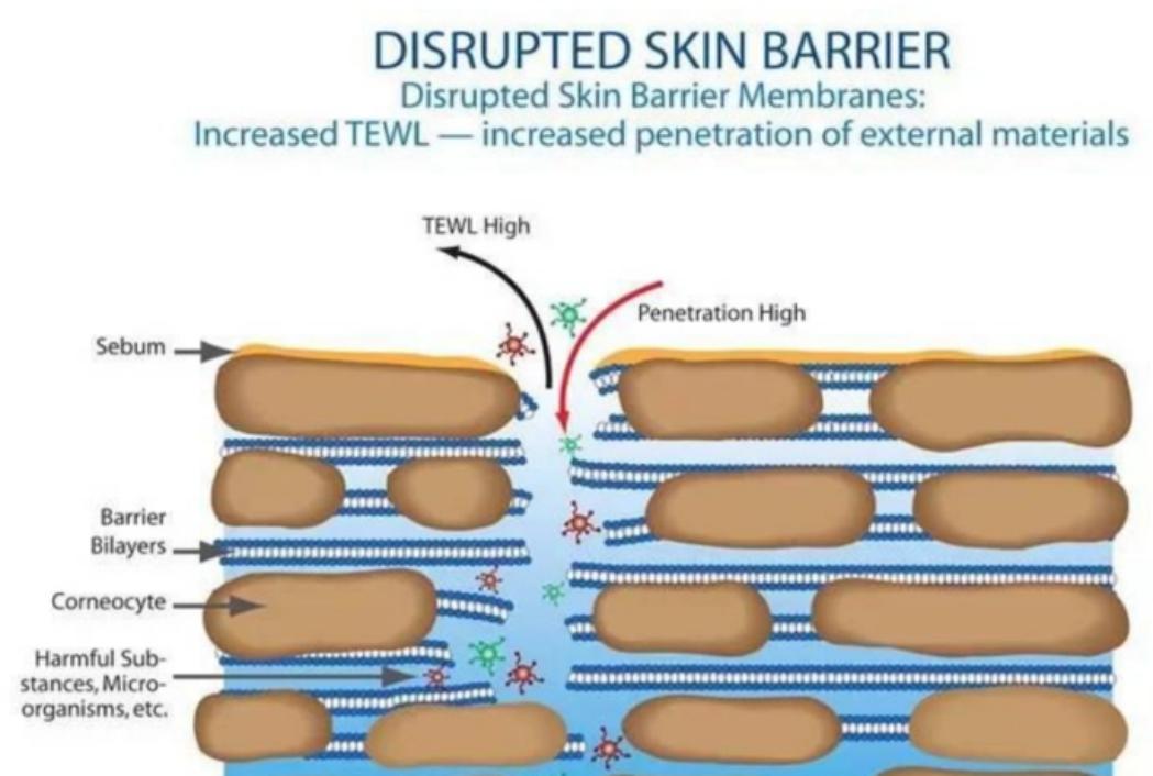 Excellent Microbial Results Published in Academic Journal JCD: Soluble ...