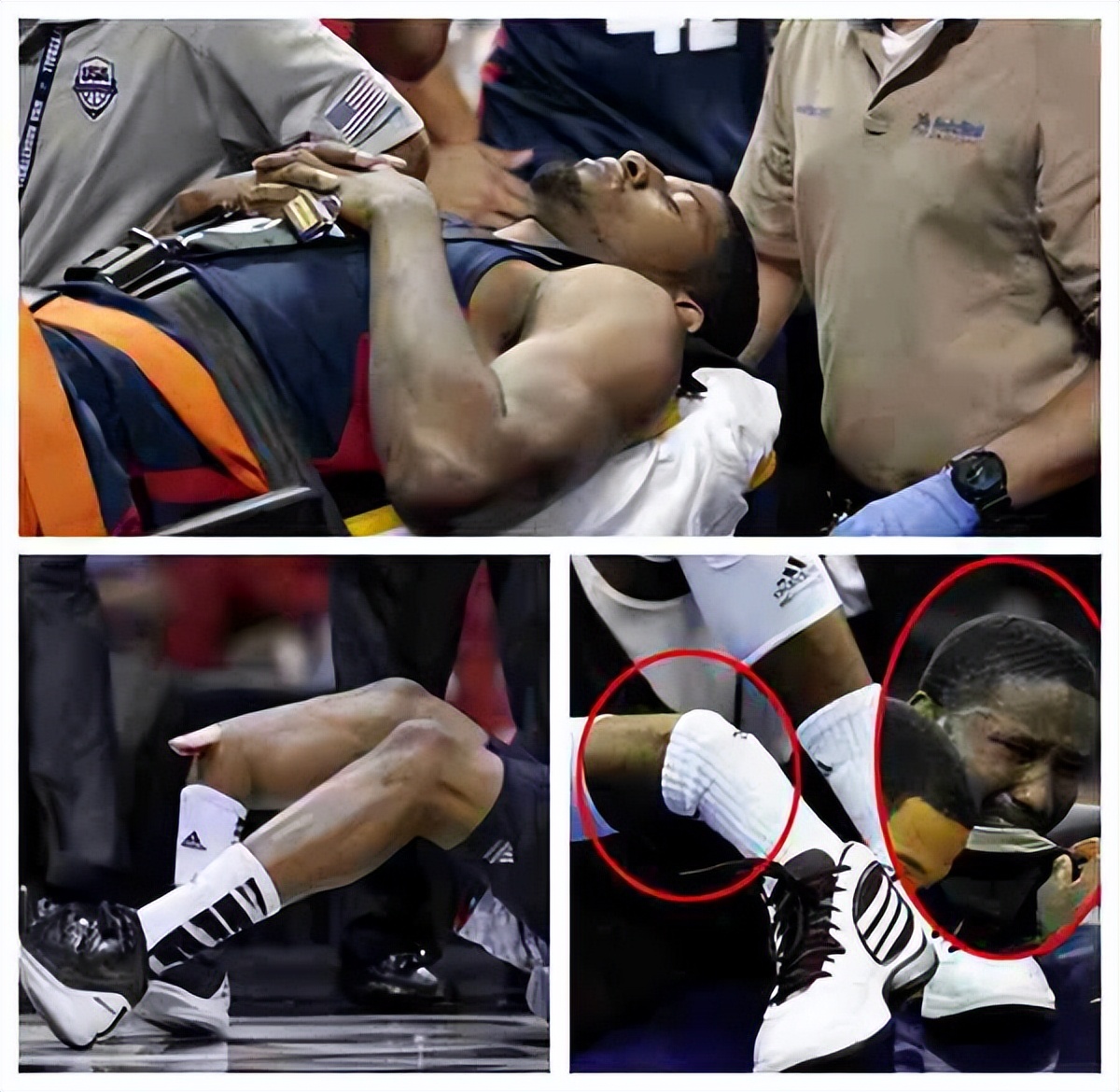 Inventory of the top five horrific injuries in the NBA, each of which ...