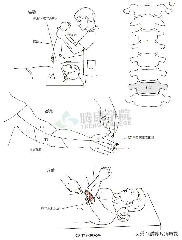 "Cervical spine and upper extremity neurological examination" - iNEWS