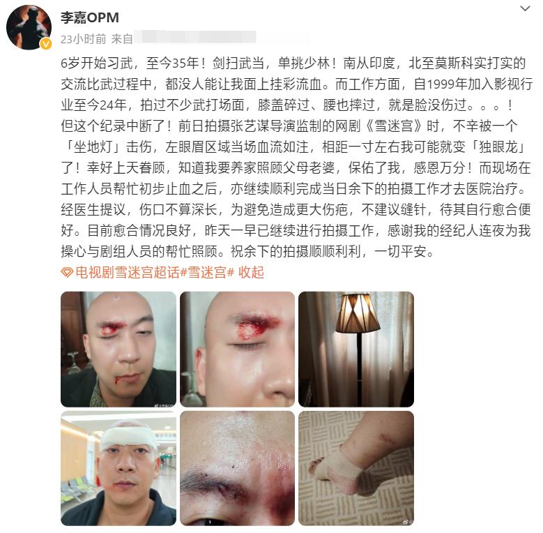 Hong Kong actor filming Zhang Yimou's new drama had an accident! The ...