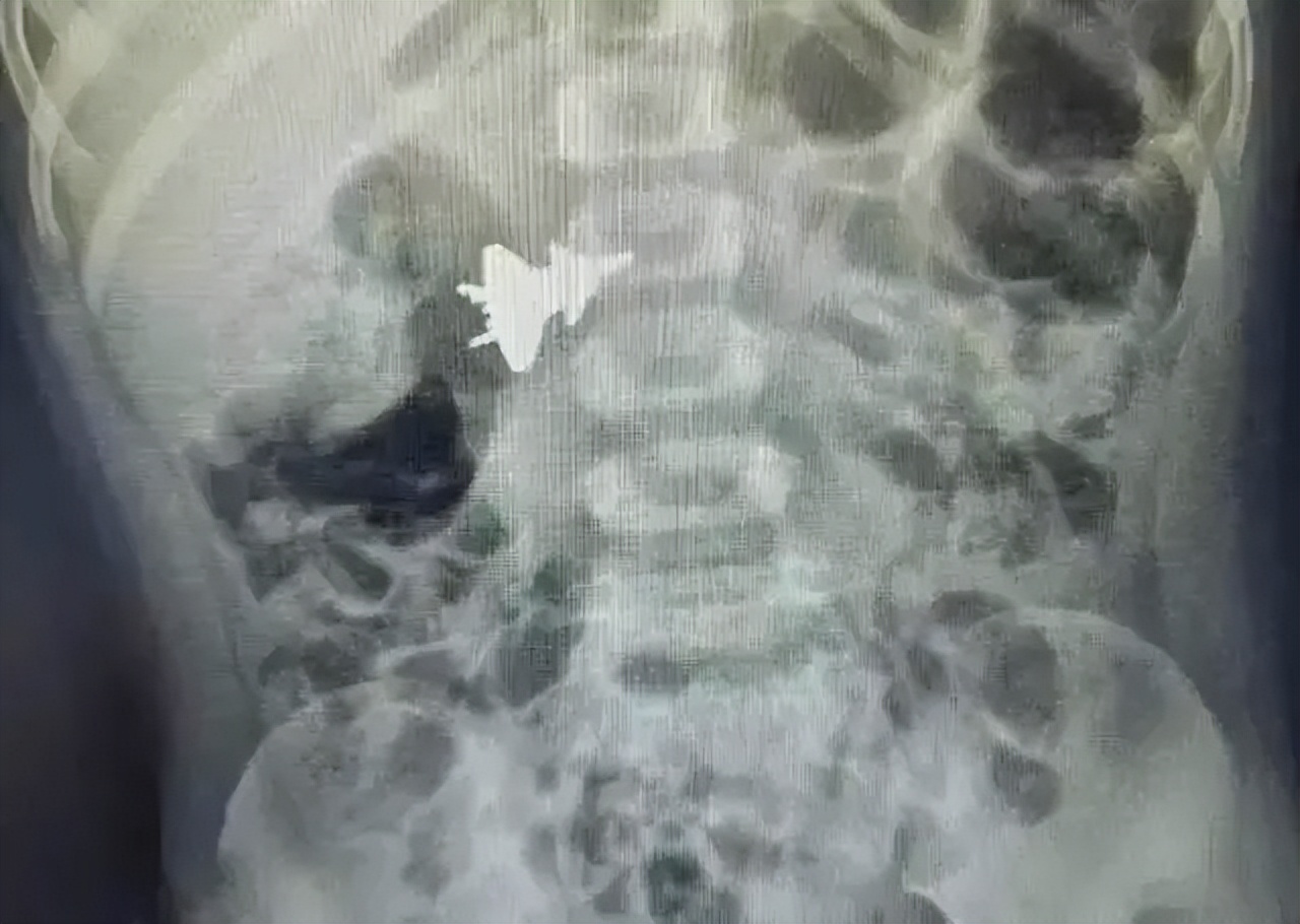 "Debunking Rumors: The Truth About Japan's F-35 Targeting J-20 and the ...