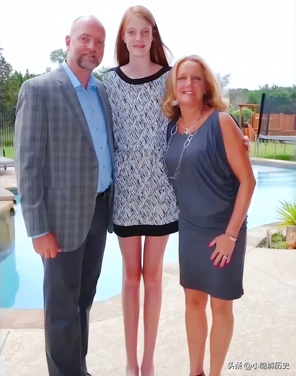 The world's largest long legs!The girl's outstanding appearance has a ...