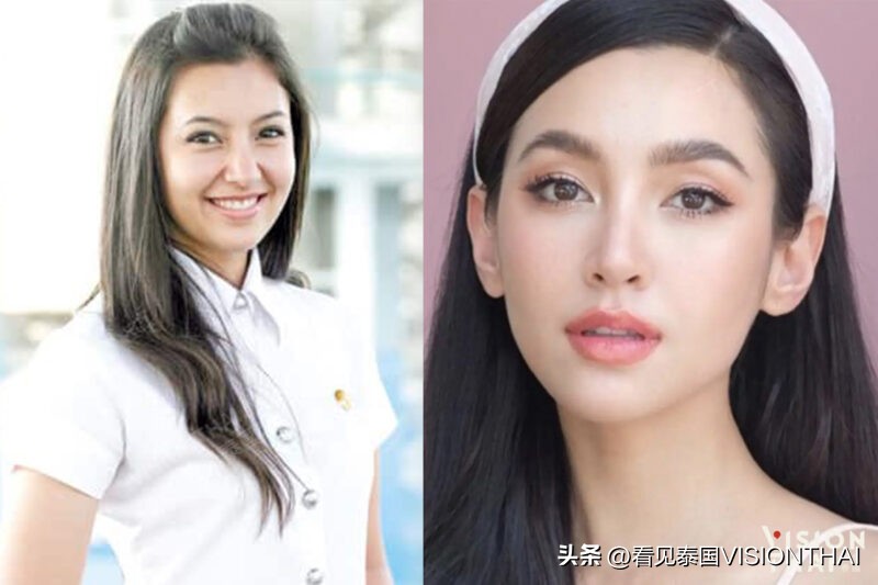 How did Taixing Bella grow before orthodontic treatment?Who are the 5 ...