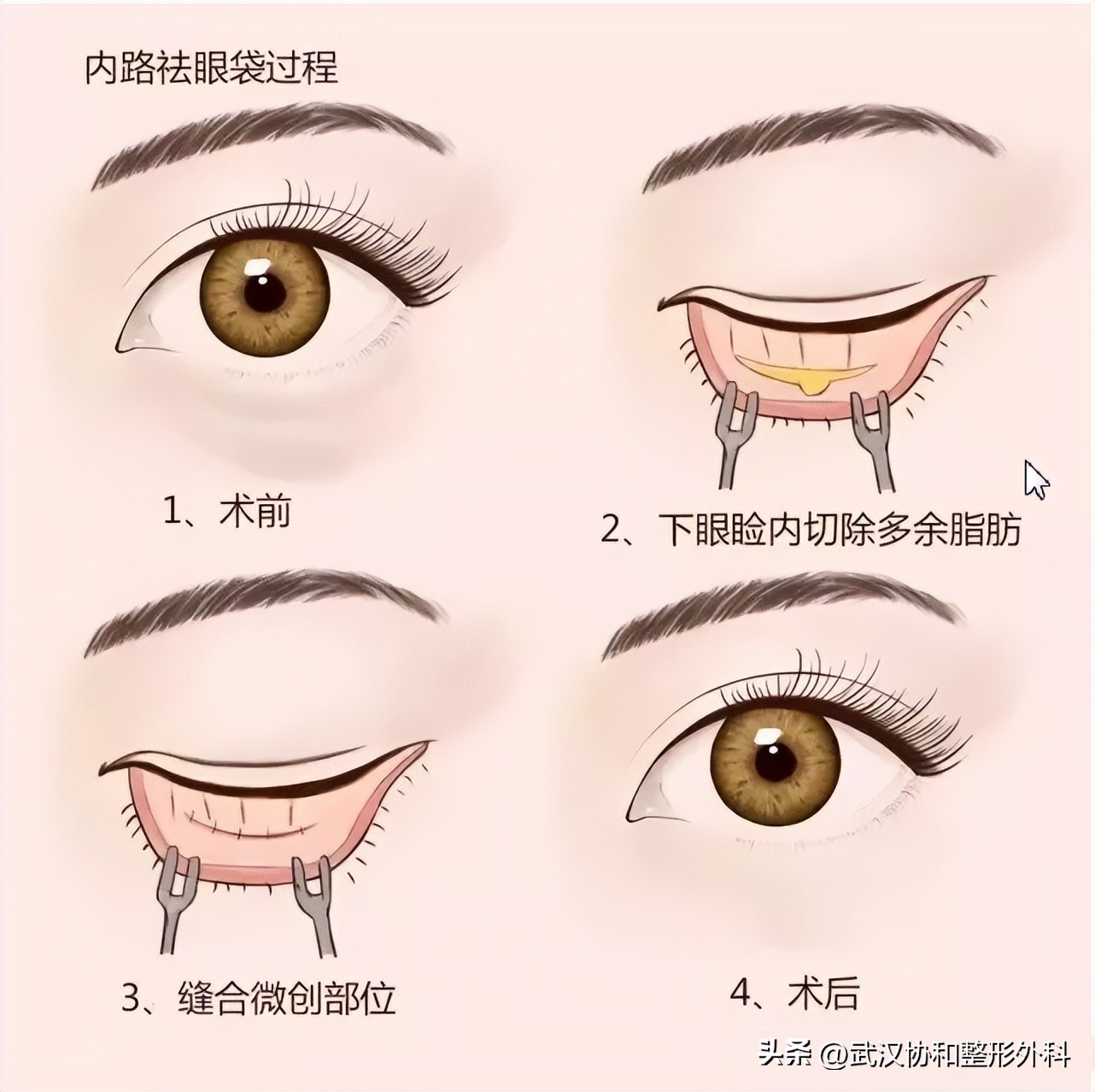 How to make eyes more vivid? - iNEWS
