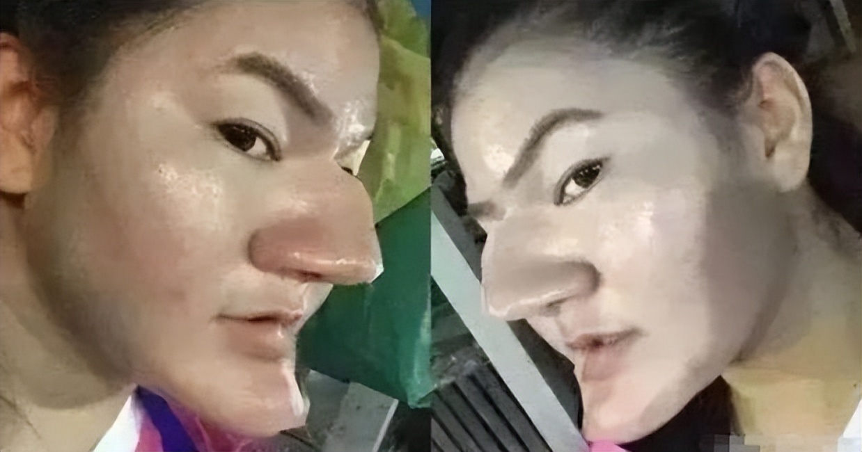 Girls spend millions on plastic surgery, want to become "princesses ...