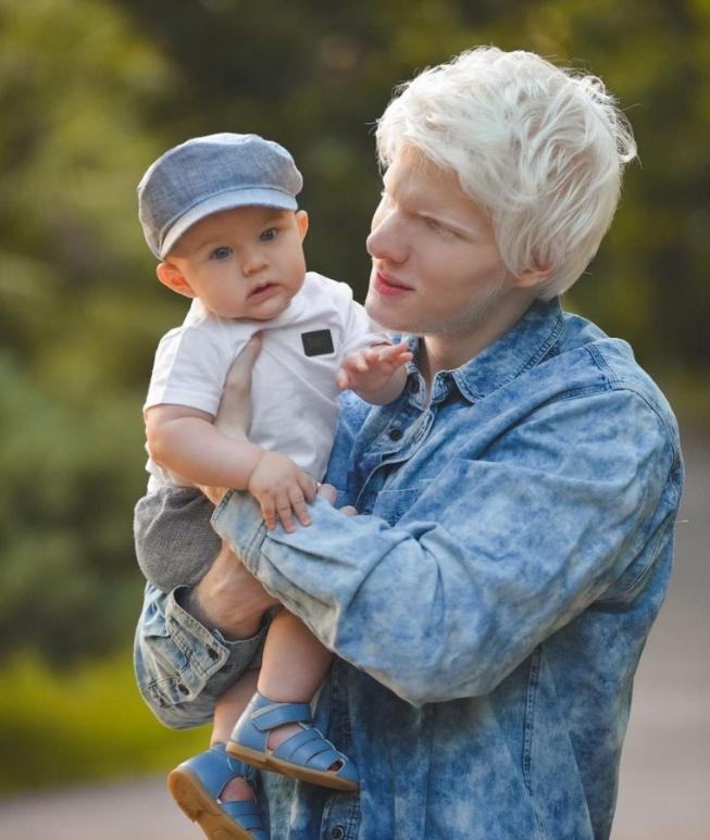 Georgia, the most handsome albino singer, married a young model, gave ...