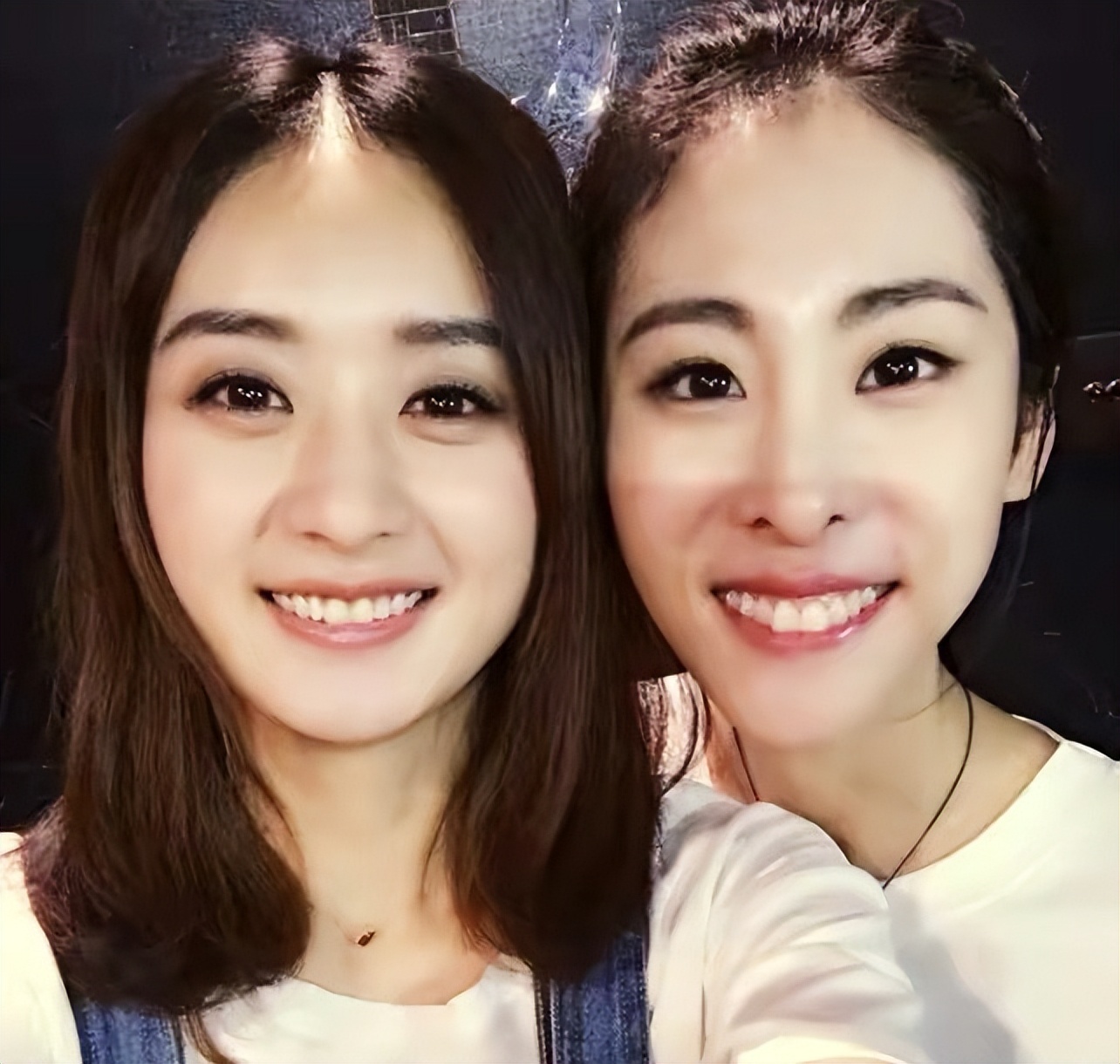 Buck teeth, dentures, large die teeth, these 12 actresses are beautiful ...
