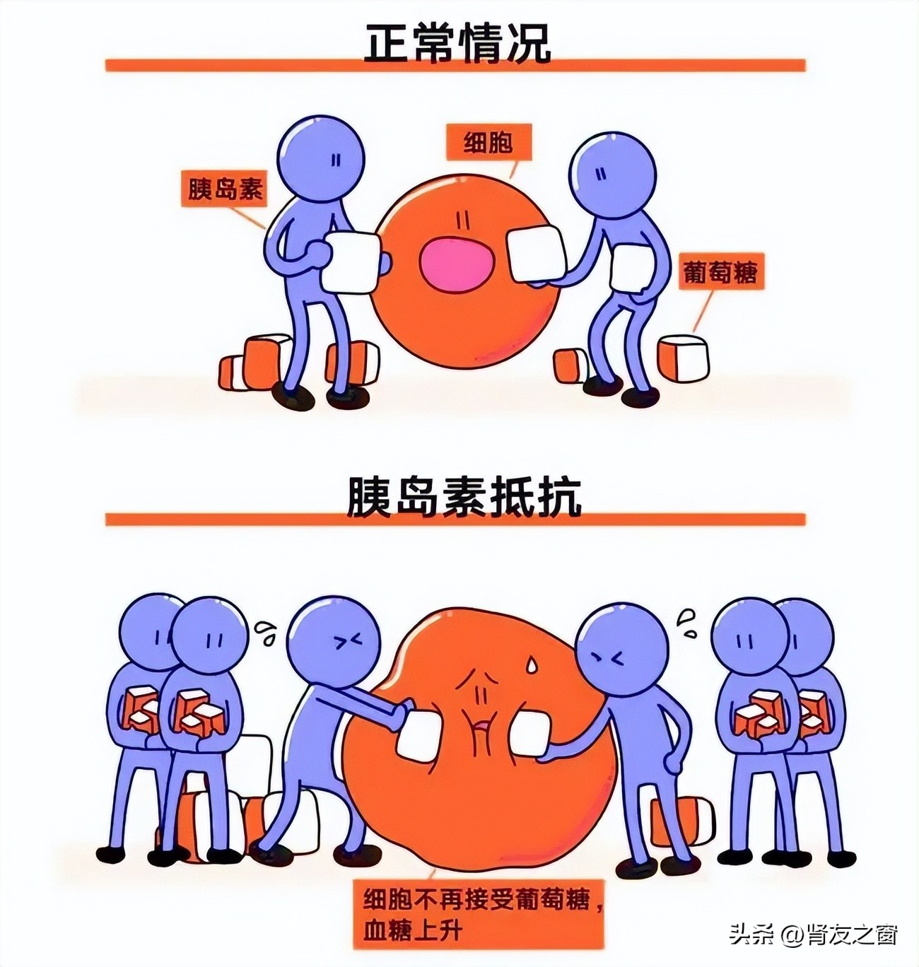 Type 2 diabetes and Parkinson's disease (PD) - iNEWS