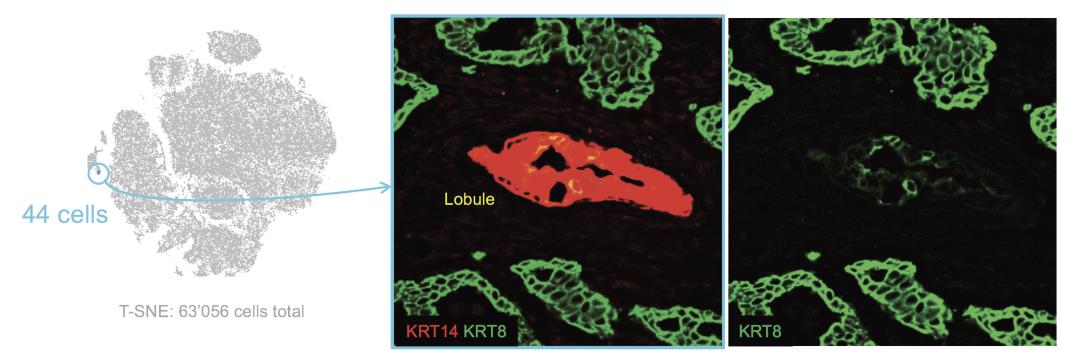 Discovery of single-cell spatial phenotypes begins with understanding ...