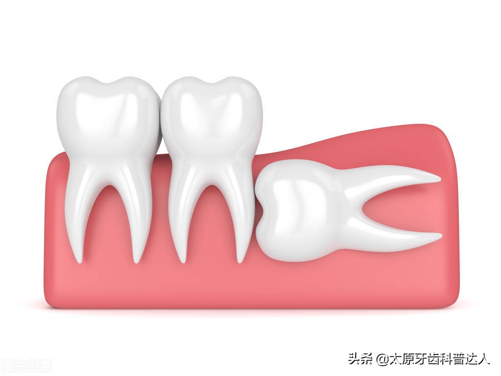 7 common factors that cause frequent tooth jams - iNEWS