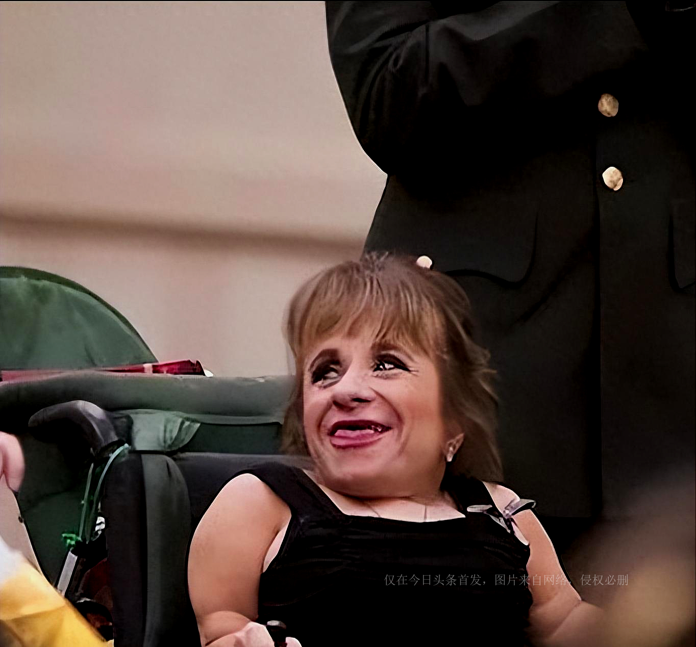 The shortest mother: 70 centimeters tall, gave birth to 3 children ...