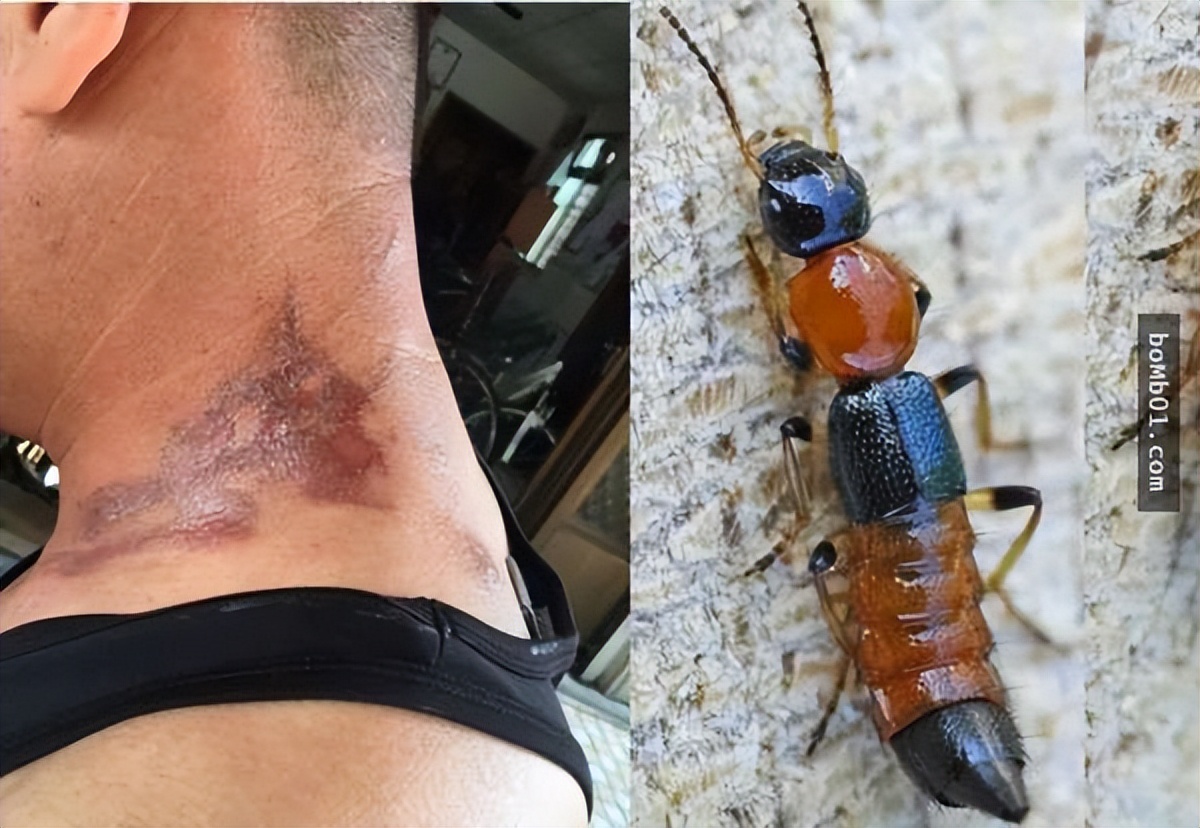 Bugs that don't bite are more dangerous! "Flying ants" are making a ...