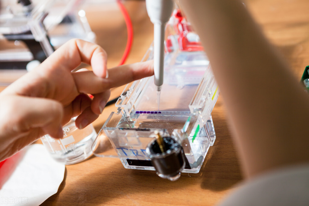 immunofixation electrophoresis - iNEWS