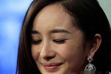 8 female celebrities whose faces were “disfigured by plastic surgery ...