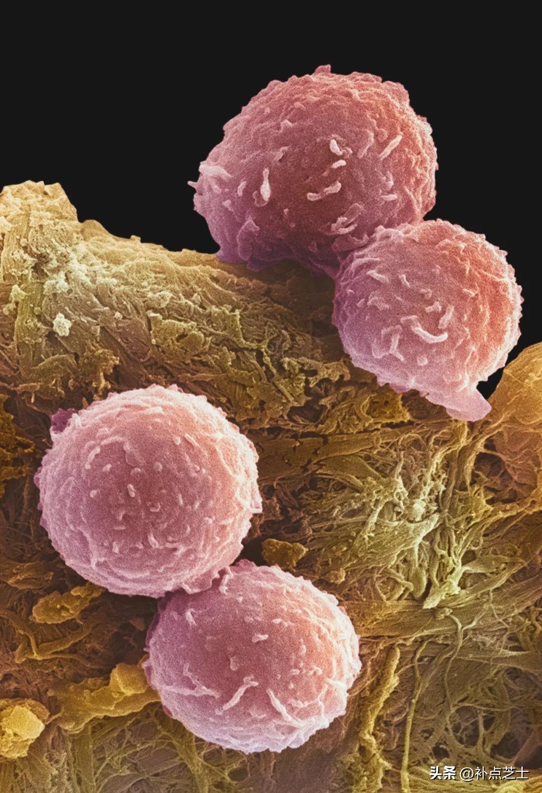 What structures does the spleen have? What role does it play in the ...