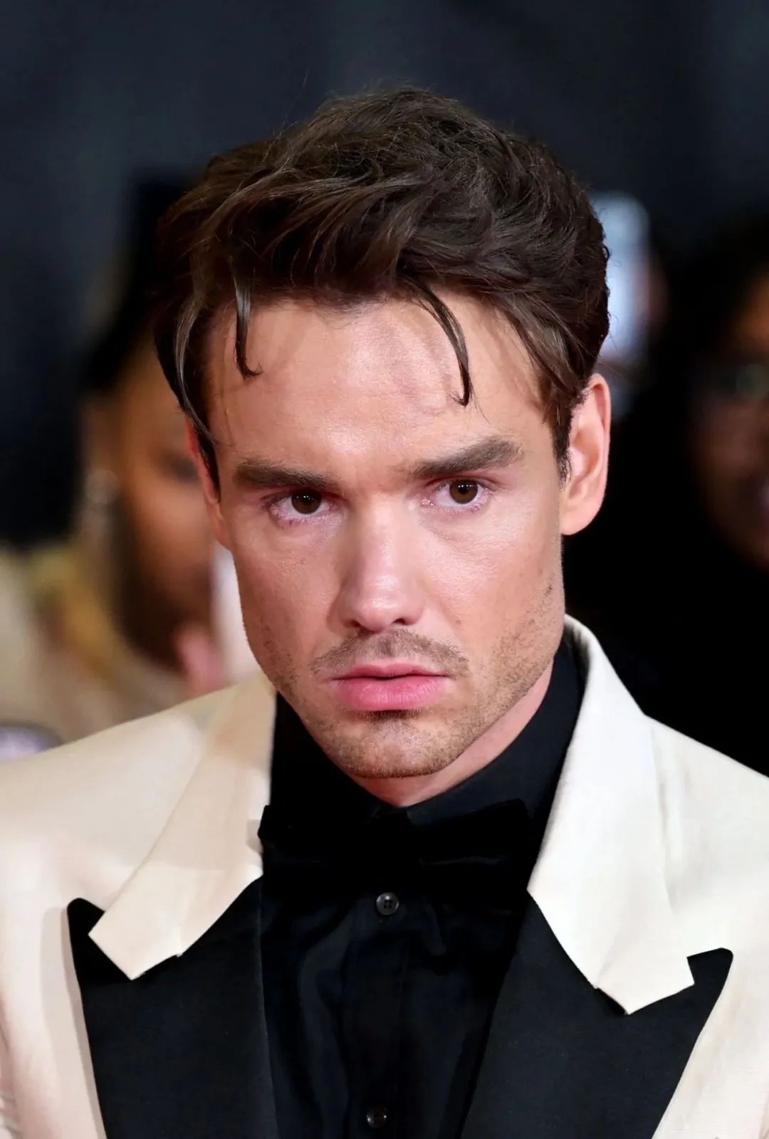 British idol actor Liam Payne suspected of plastic surgery, enlarged ...