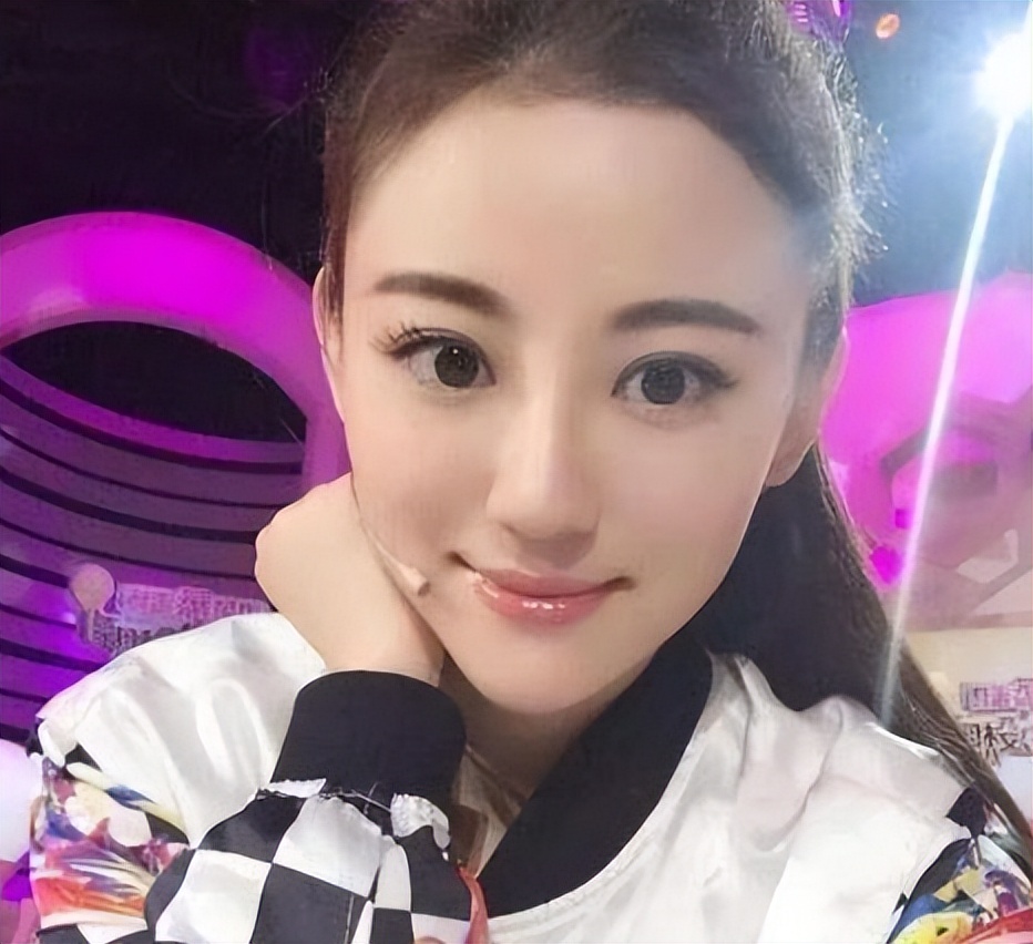 "Cash cow" Xu Ting: At the age of 26, her whole body festered and died ...