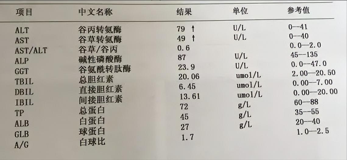 What's the matter with elevated ALT, must it be liver disease?This ...