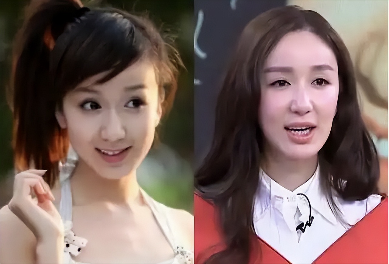 Obviously they can rely on acting skills, but they are obsessed with plastic surgery, don't they ...