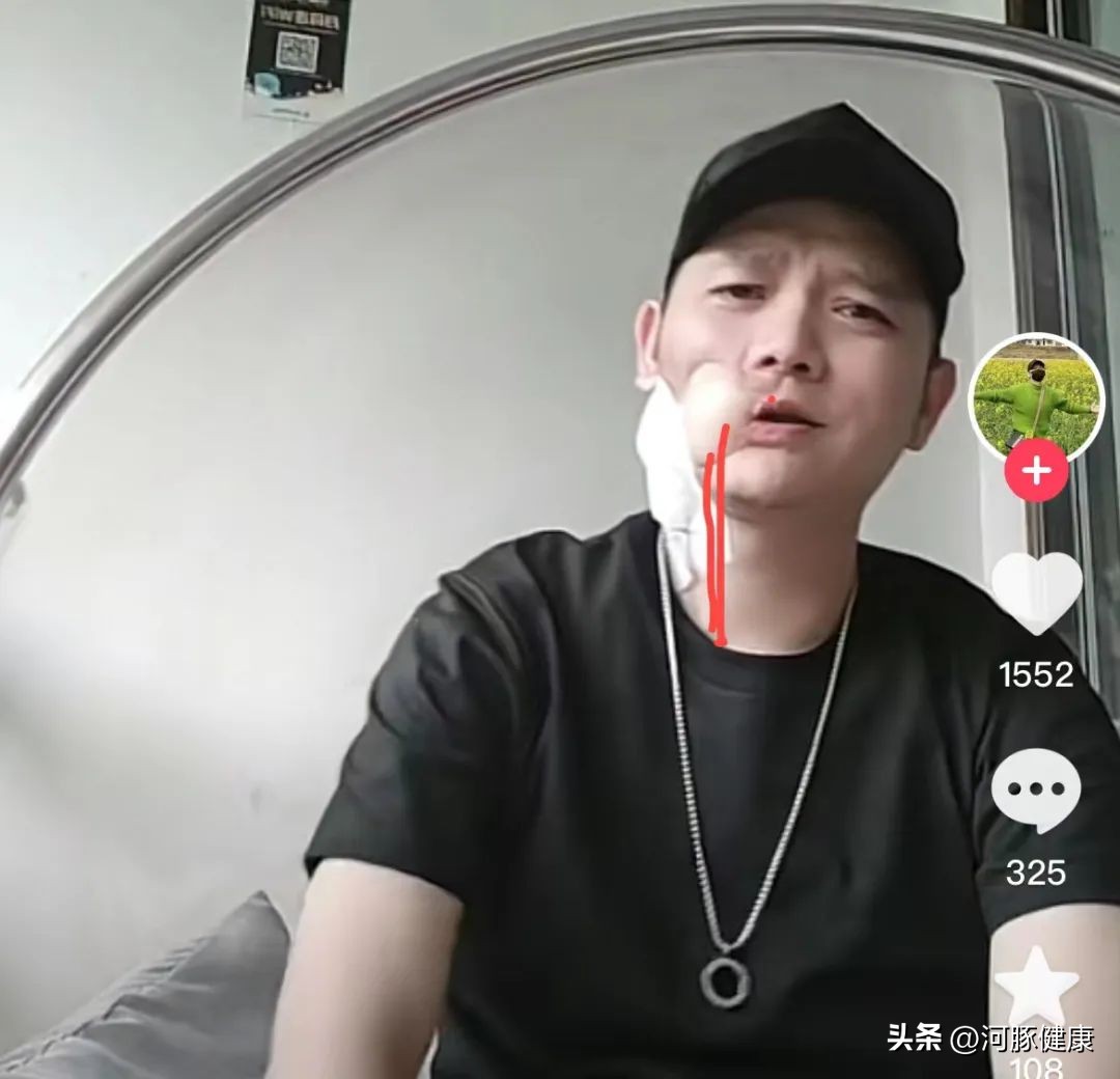 36-year-old singer Fu Song died of oral cancer, betel nut is really ...