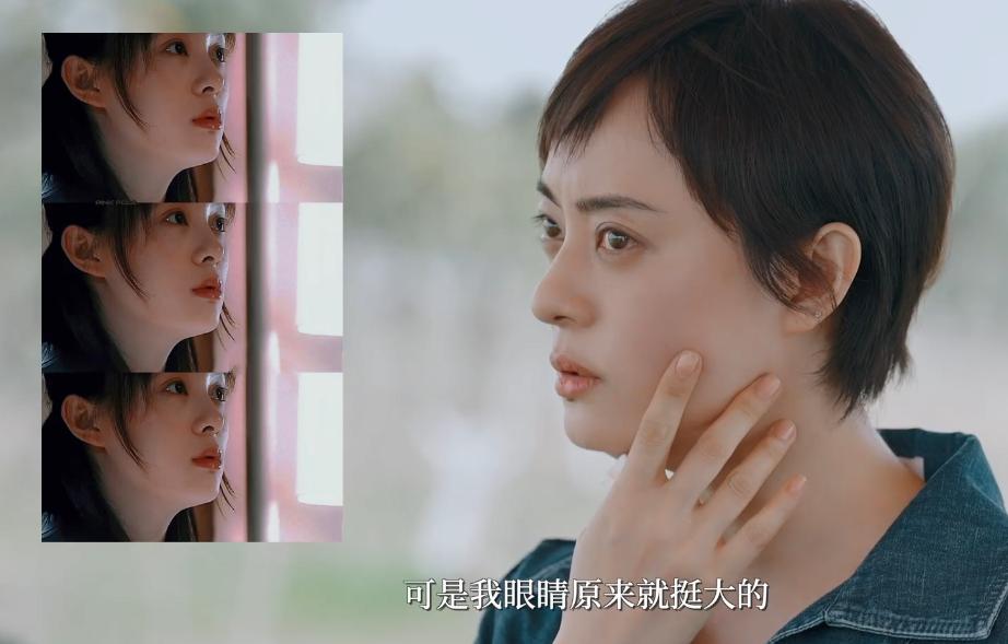 Sun Li clarifies the suspicion of hyperthyroidism! The doctor who ...