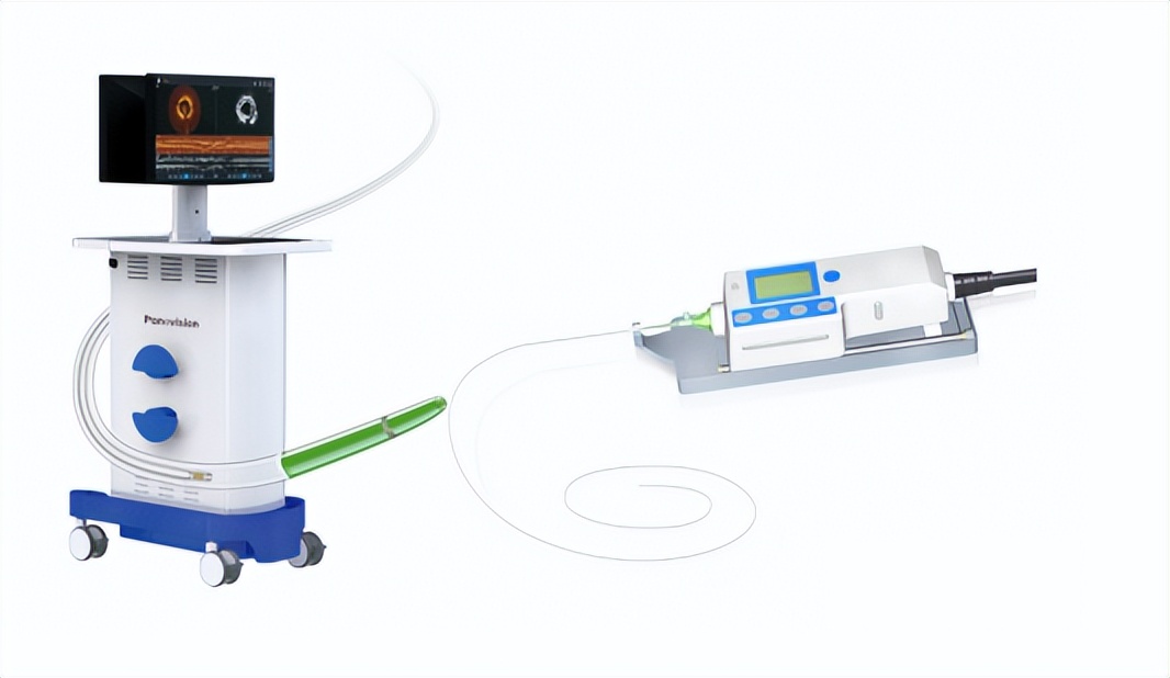 The first domestically produced "IVUS and OCT two-in-one" intravascular ...