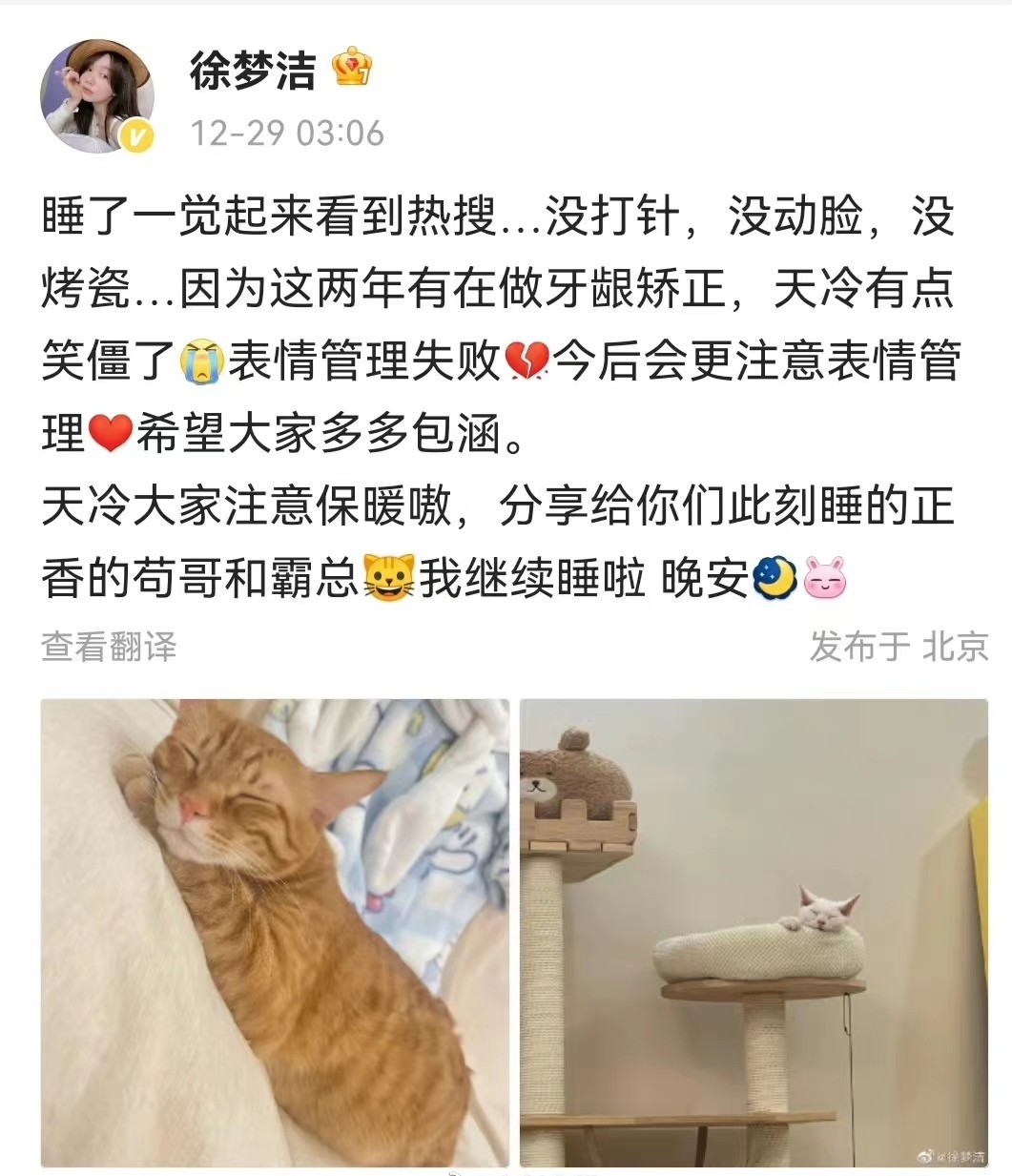 Xu Mengjie's plastic surgery failed?Attending the event, the face was stiff, and netizens said ...