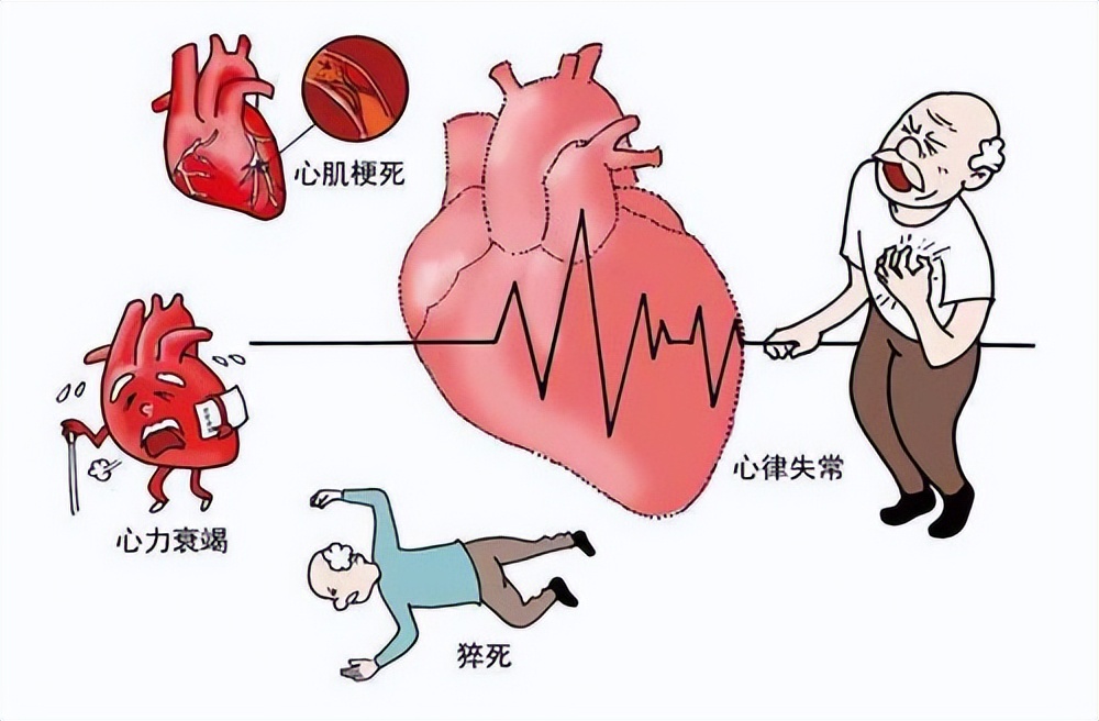 When coronary heart disease attacks, it is really useful to remember ...