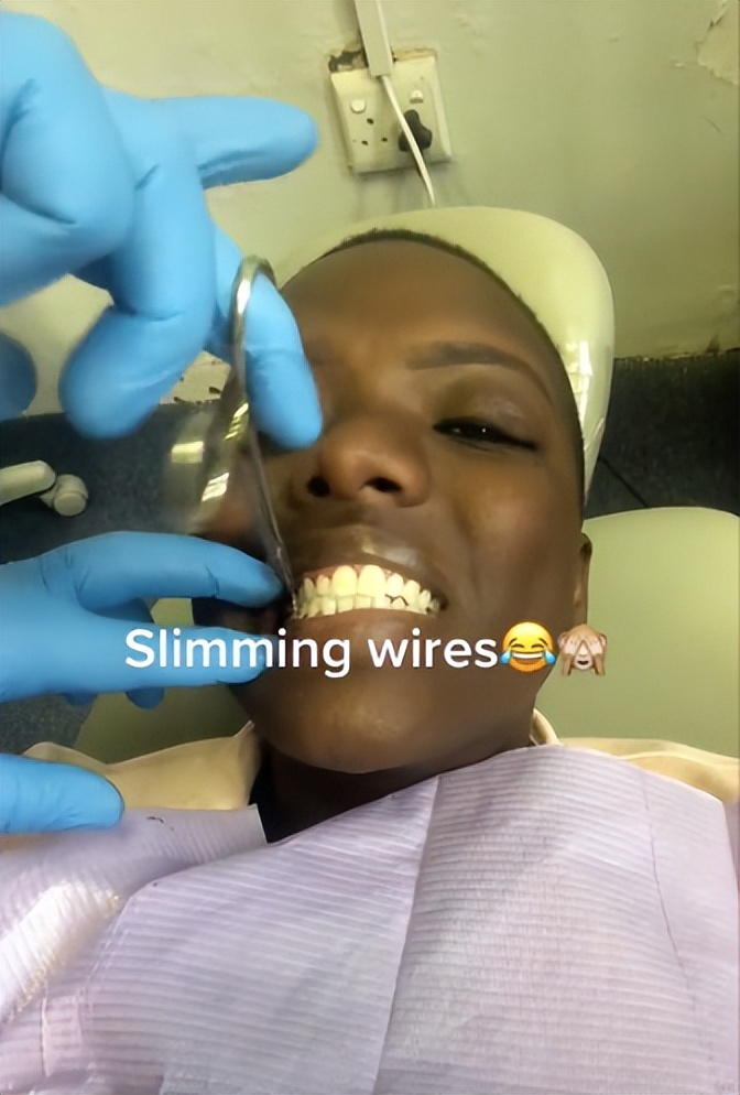 In order to lose weight, they sewed their teeth together and forcibly ...