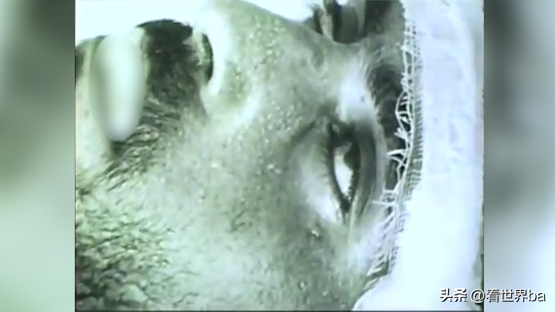 How scary is rabies? The doctor photographed the real scene of the ...