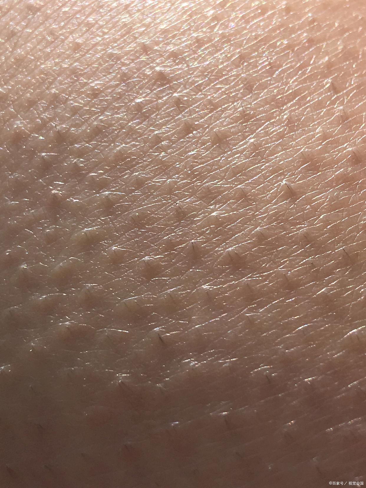 Are enlarged pores hopeless? "Prescribe the right medicine" to shrink ...