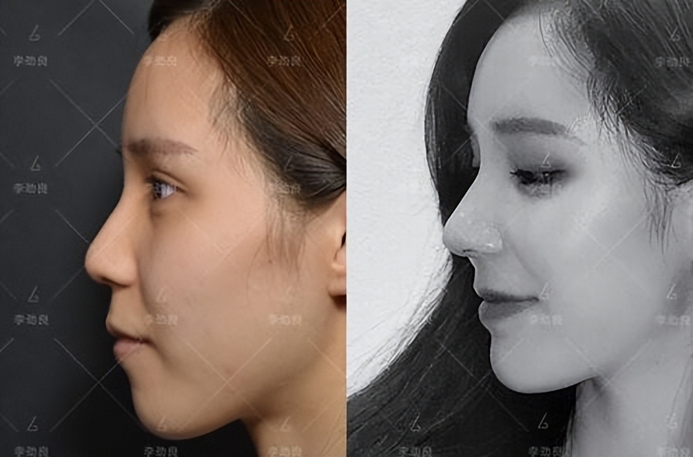 Liu Yifei Di Lieba's side face fairy picture detonates the beauty of ...