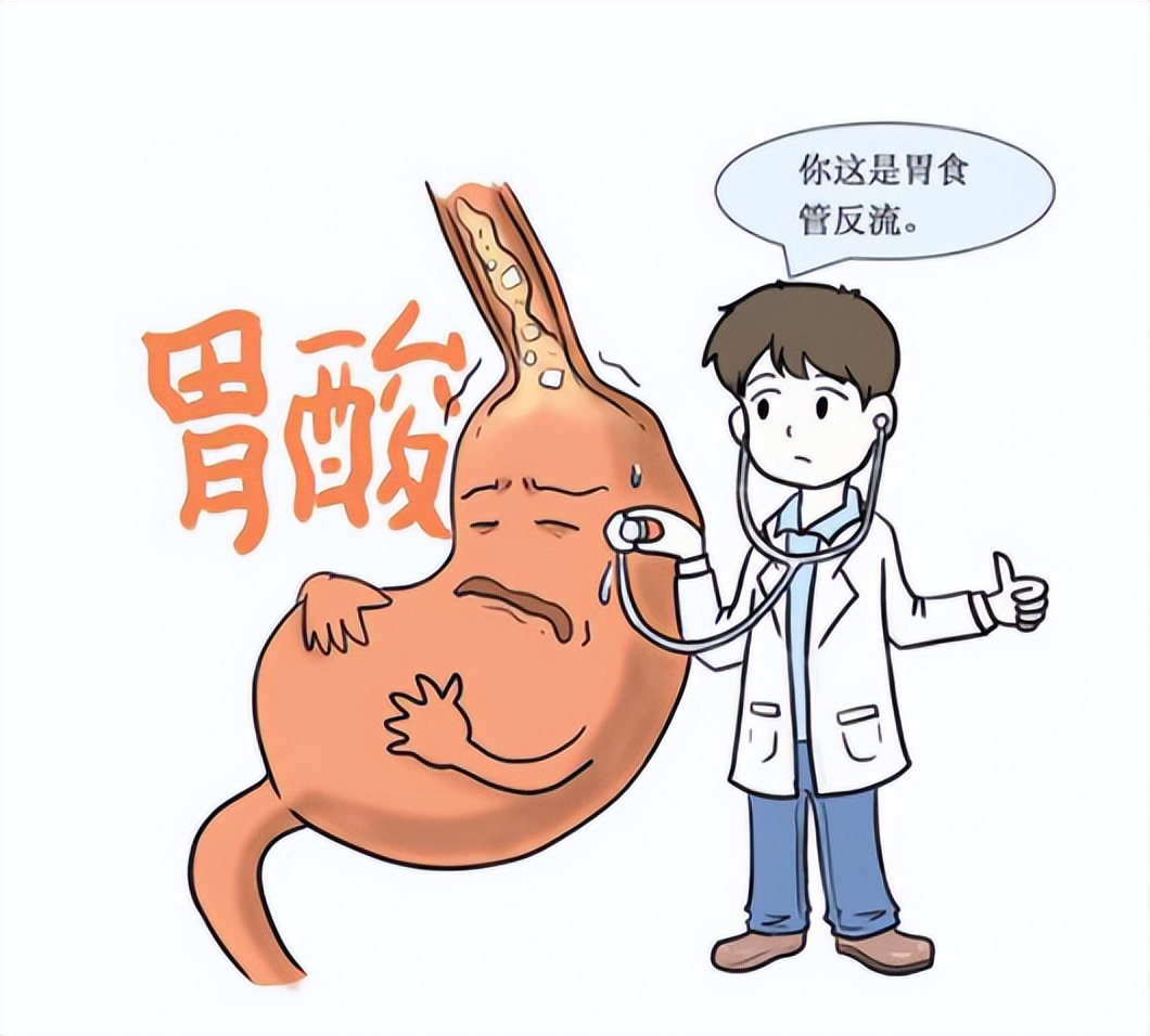 In 1968, three cases of throat ulcers caused by gastroesophageal reflux ...