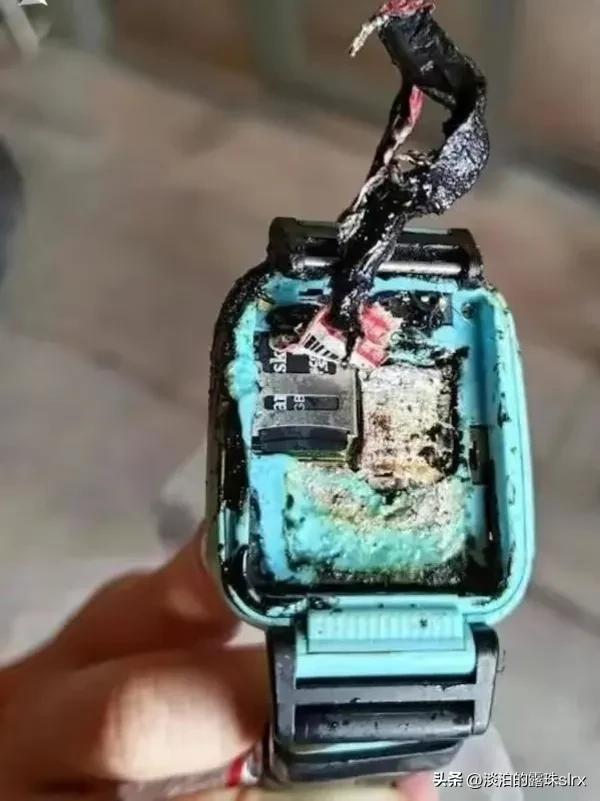 Smartwatch explodes into flames, terrifies 10-year-old boy, causing ...