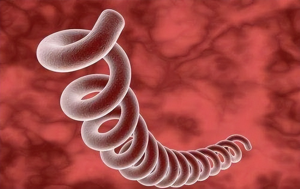 What are the symptoms of syphilis?Does it itch?Can syphilis be cured?It ...