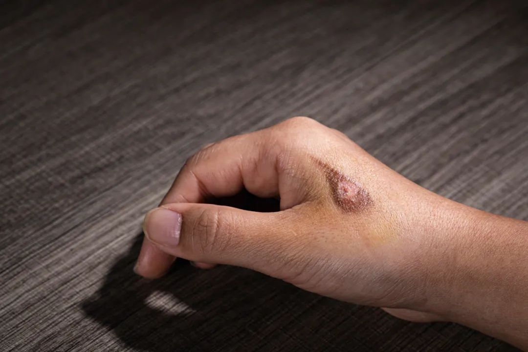 These 5 symptoms may appear due to weakened immunity, and you must pay ...