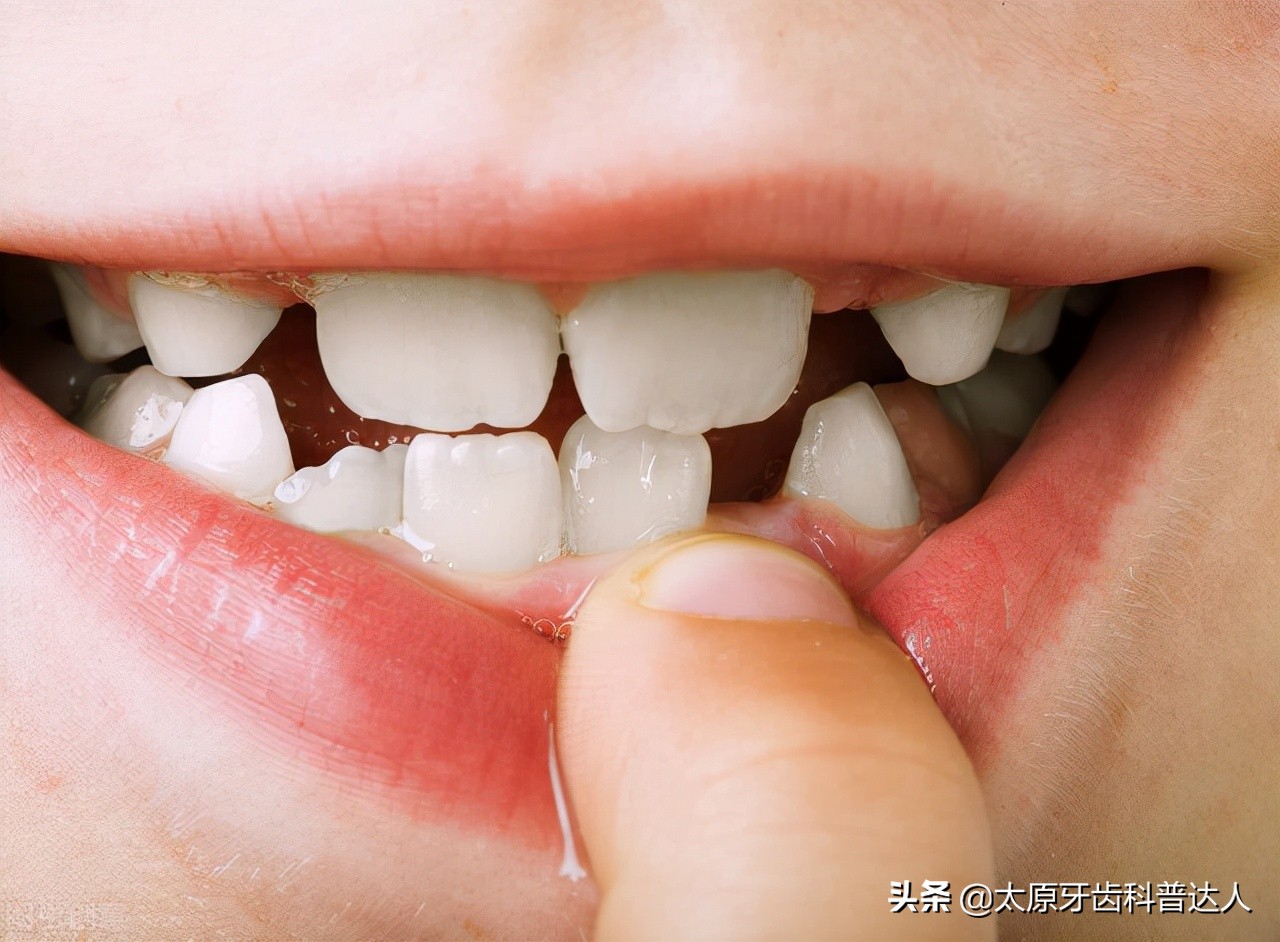 7 common factors that cause frequent tooth jams - iNEWS