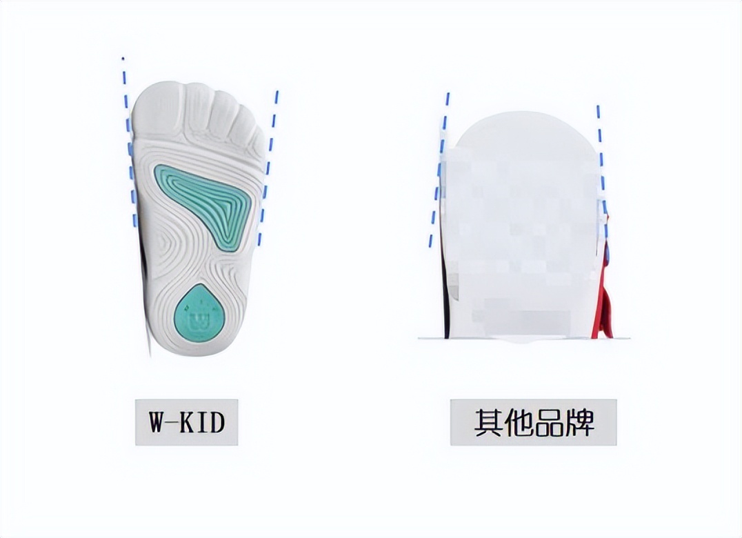 Why does kicking a toe hurt so much?Children's health shoe expert ...