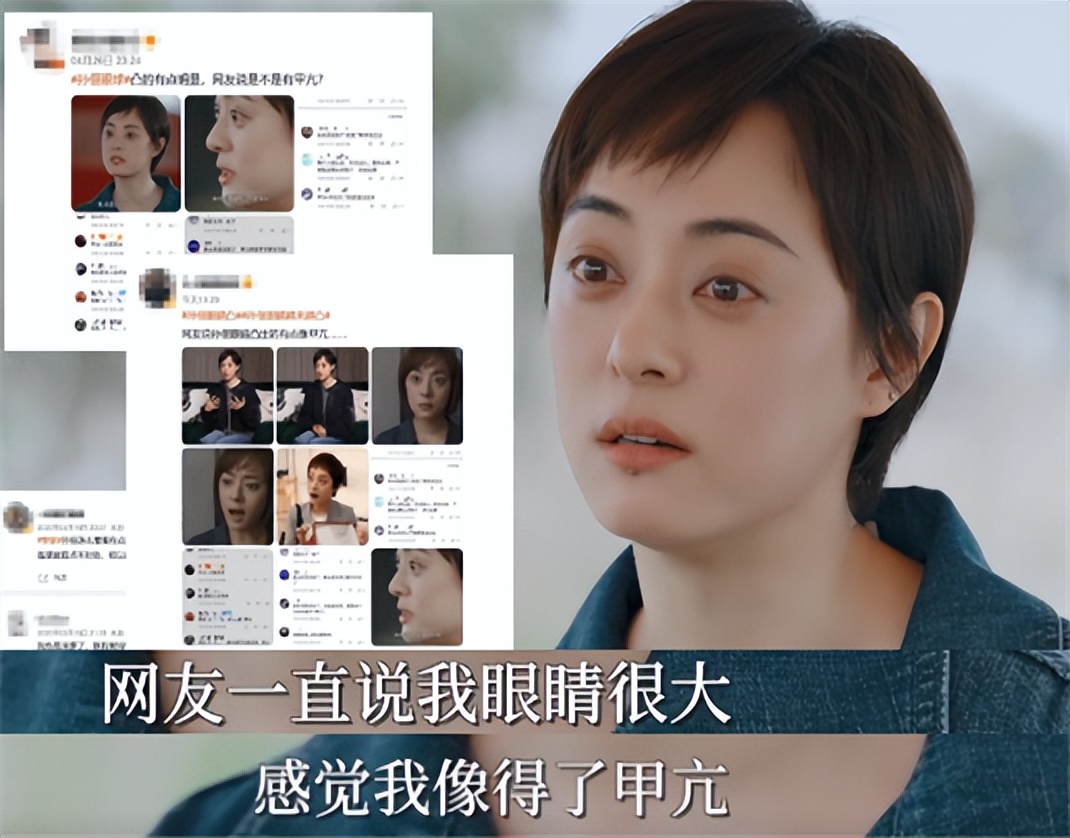 Sun Li clarifies the suspicion of hyperthyroidism! The doctor who ...