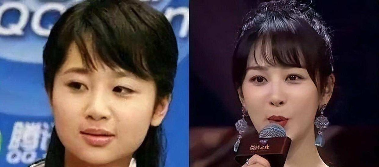 These female celebrities have obvious signs of plastic surgery, but ...
