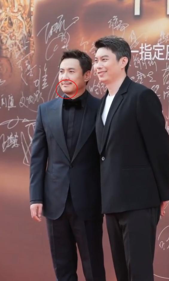 Shen Teng made his first public appearance after cervical spine surgery ...