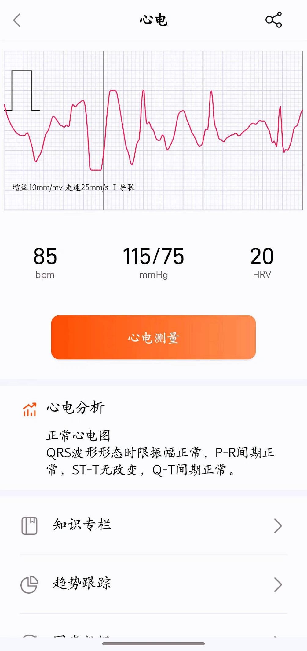 dido E10 blood pressure ECG smart watch, give parents a protection, give yourself a peace of ...