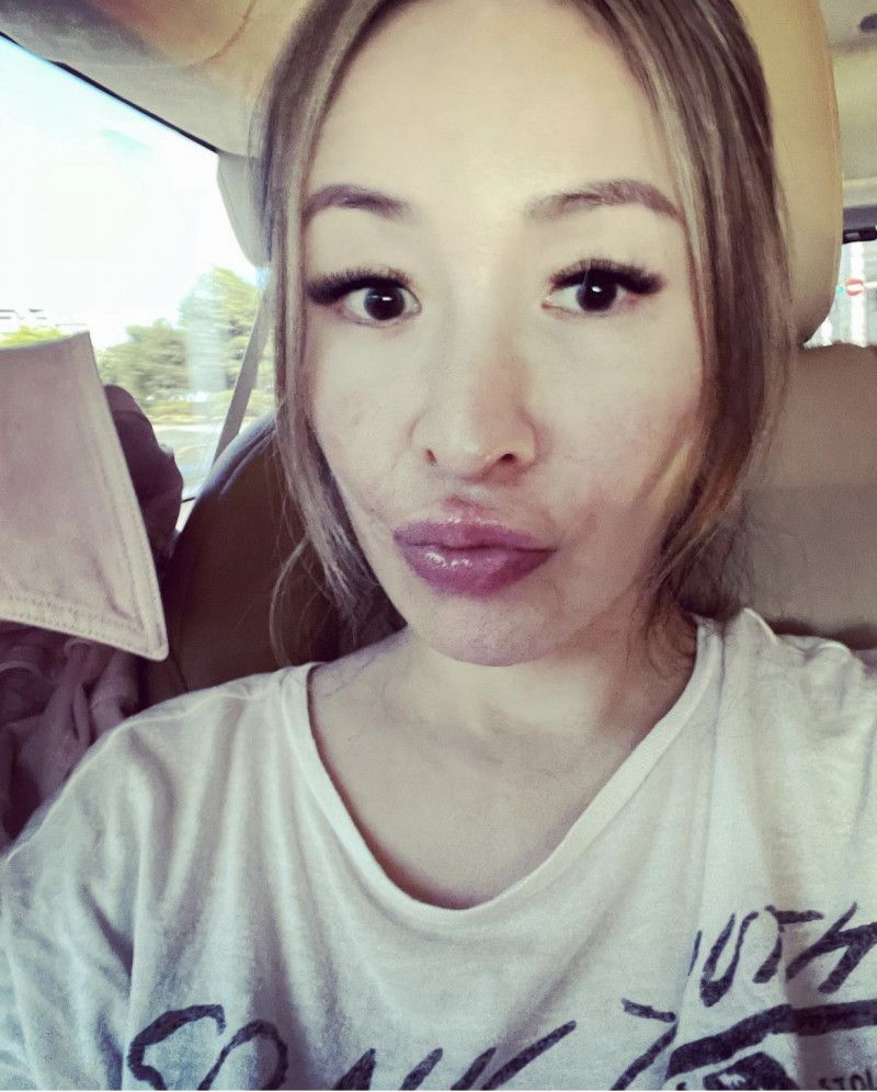 After the eagle nose storm, Xiao Yaxuan posted another disfigured photo ...