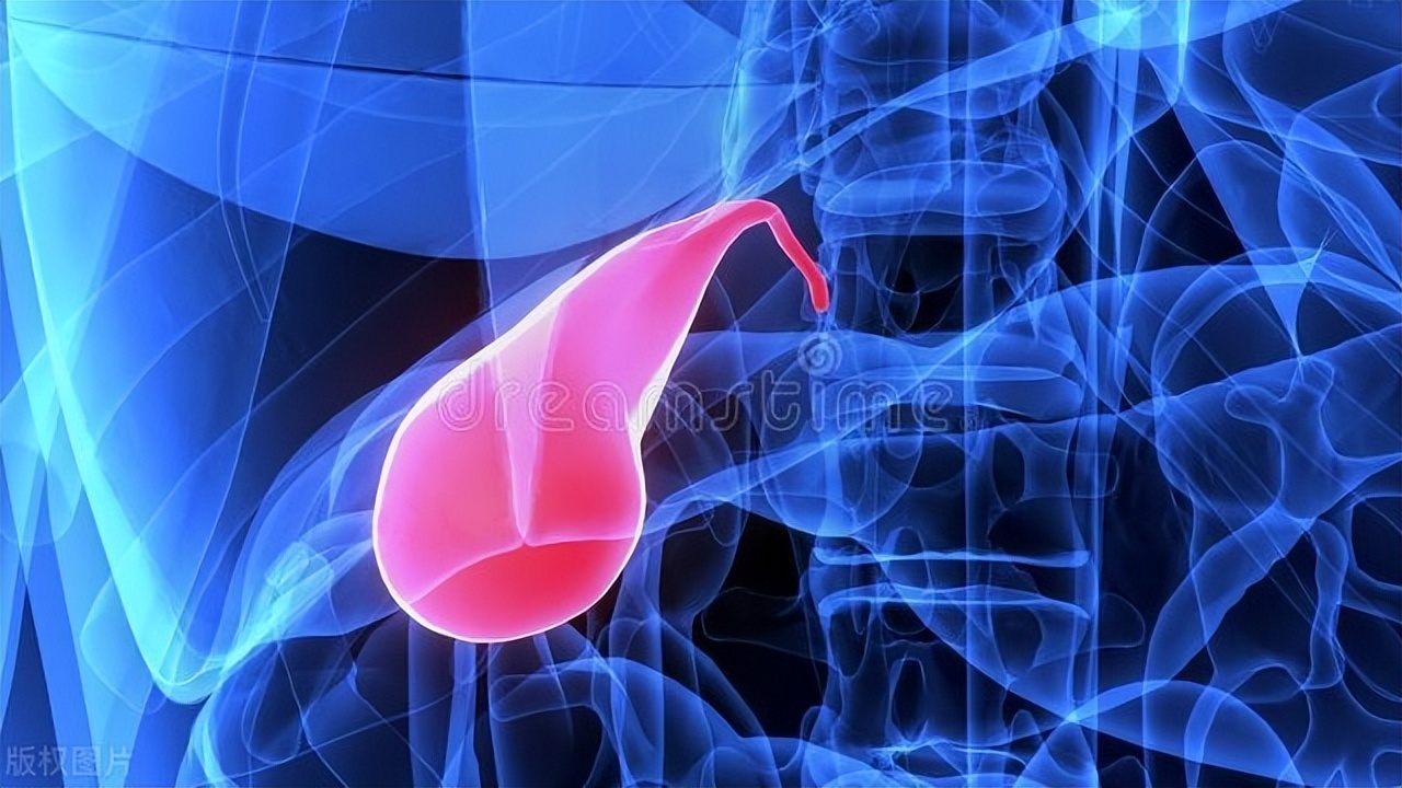 What are the advantages of laparoscopic cholecystectomy over ...