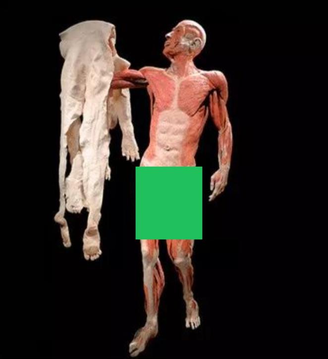 Corpse art from death? - iMedia