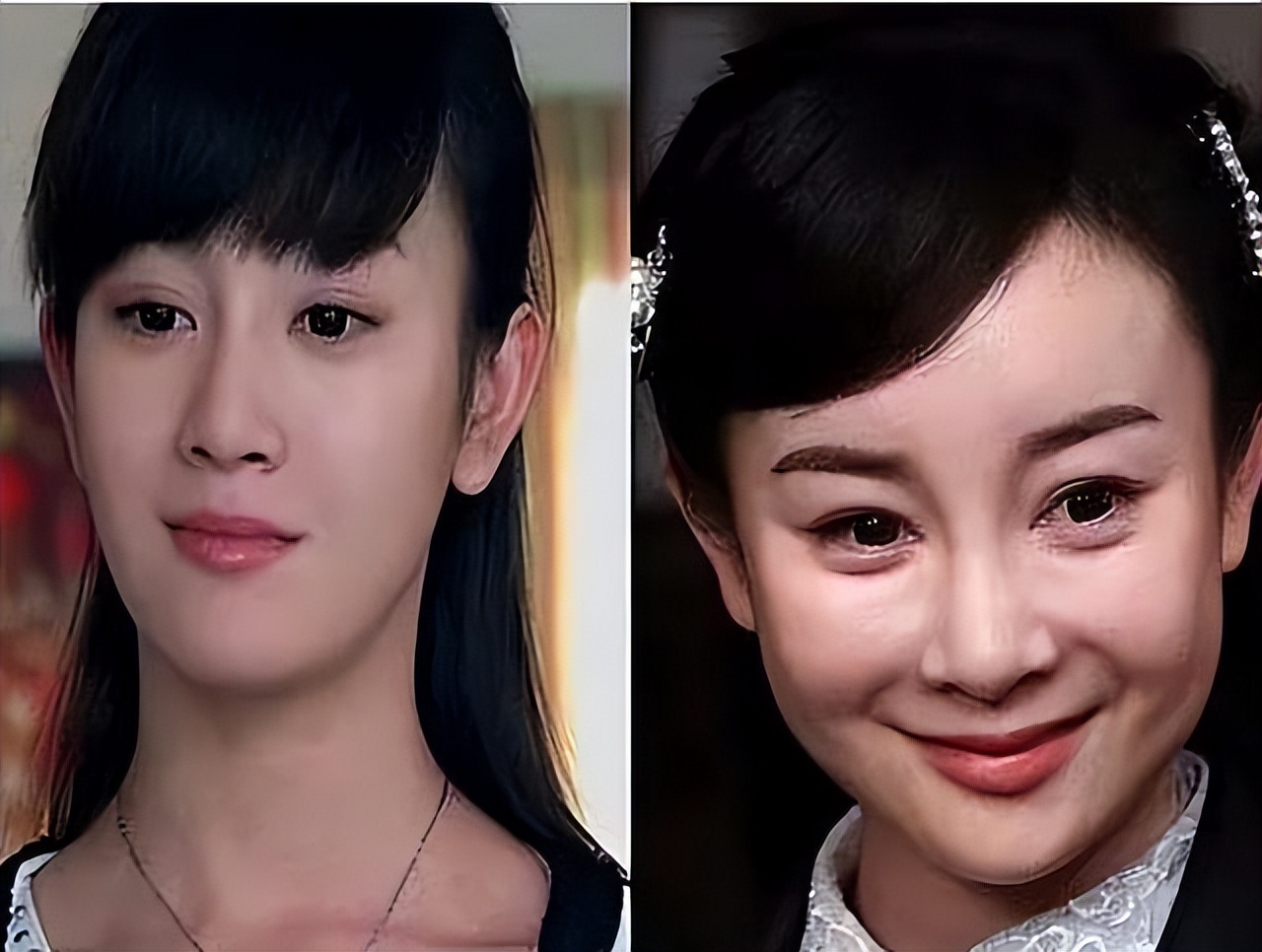 The faces of several celebrities with excessive plastic surgery are ...