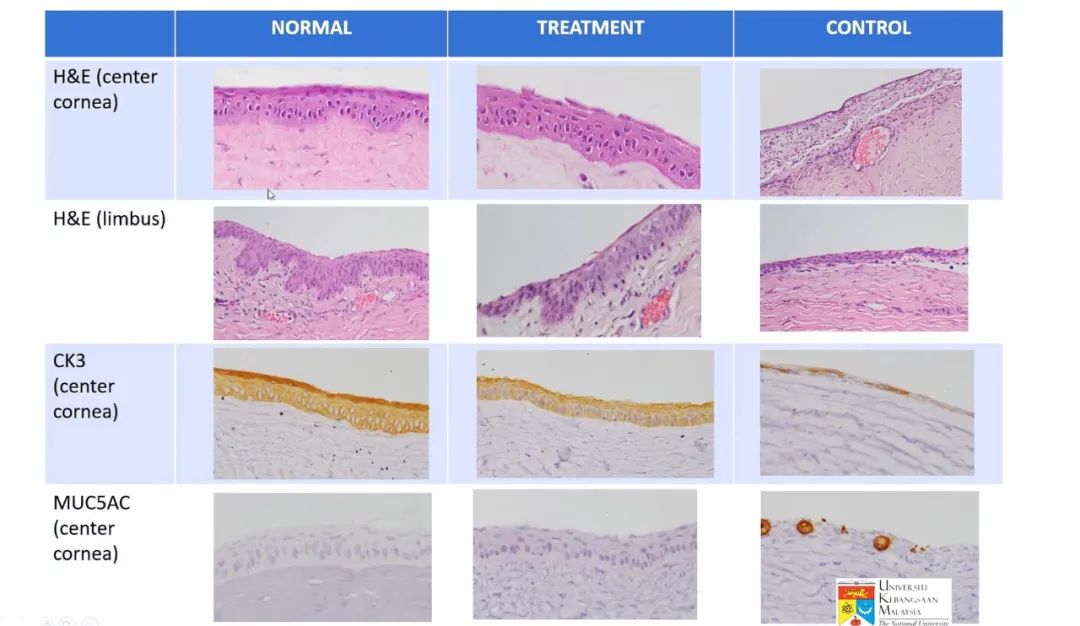 A New Approach to Treat Corneal Blindness Caused by Limbal Stem Cell ...