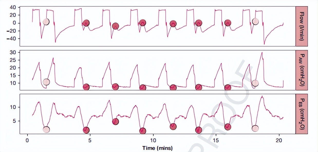 Professor Luo Hong: How to identify "reverse trigger" during mechanical ...