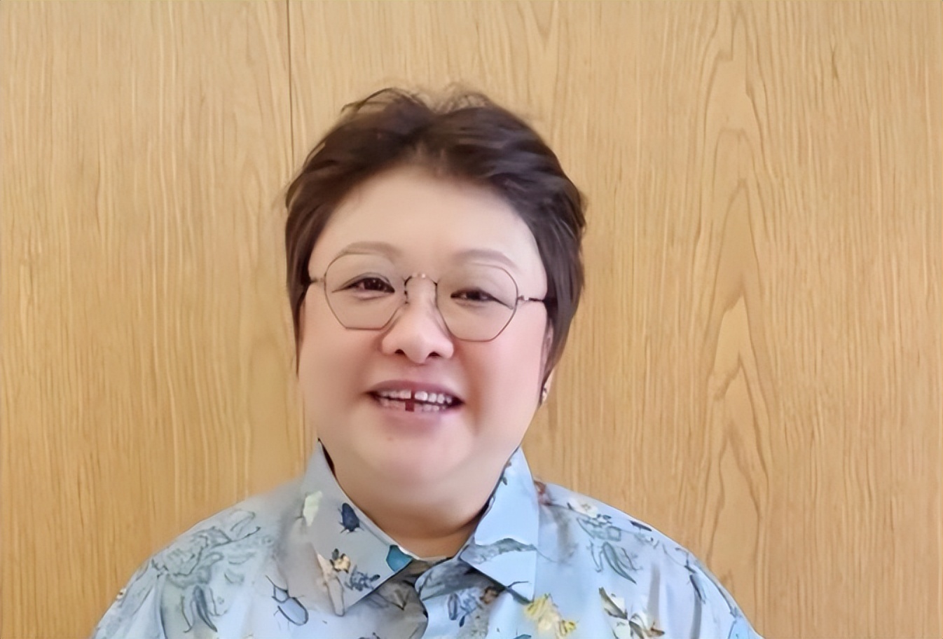 Han Hong recently appeared thinner, missing many teeth and swollen eyes ...